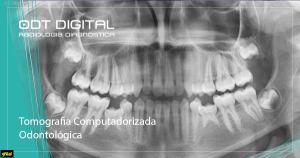 O que é agenesia? – DRX Radiologia